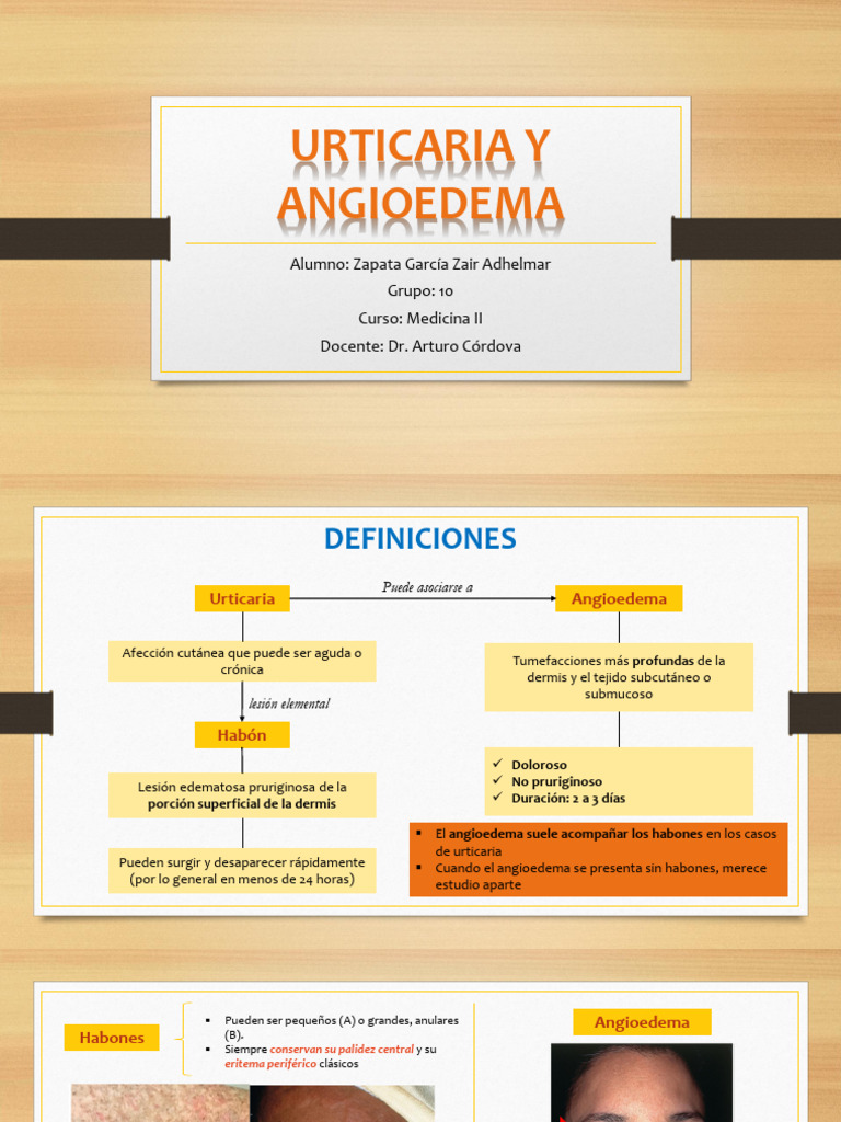 Tema 3 - Urticaria y Angioedema | PDF | Inflamación | Alergia