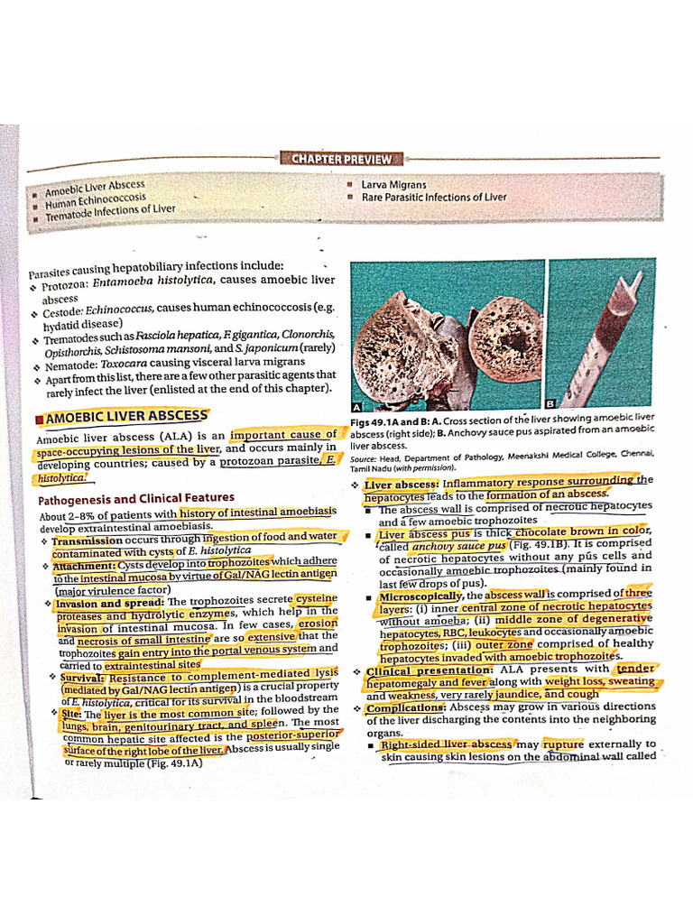 Hepatobiliary System | PDF