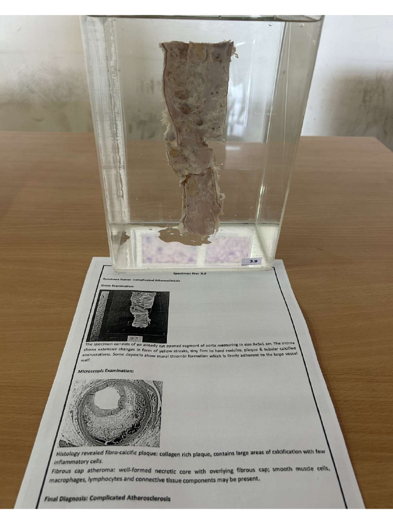 Heart Specimen | PDF