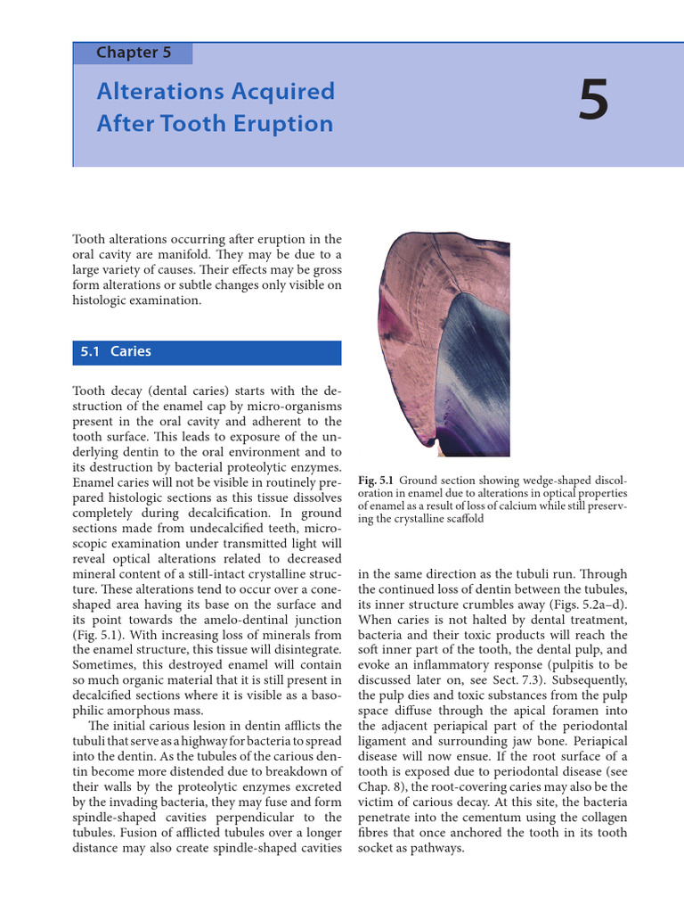 Tooth Eruption Alterations Explained | PDF | Human Tooth | Tooth Enamel