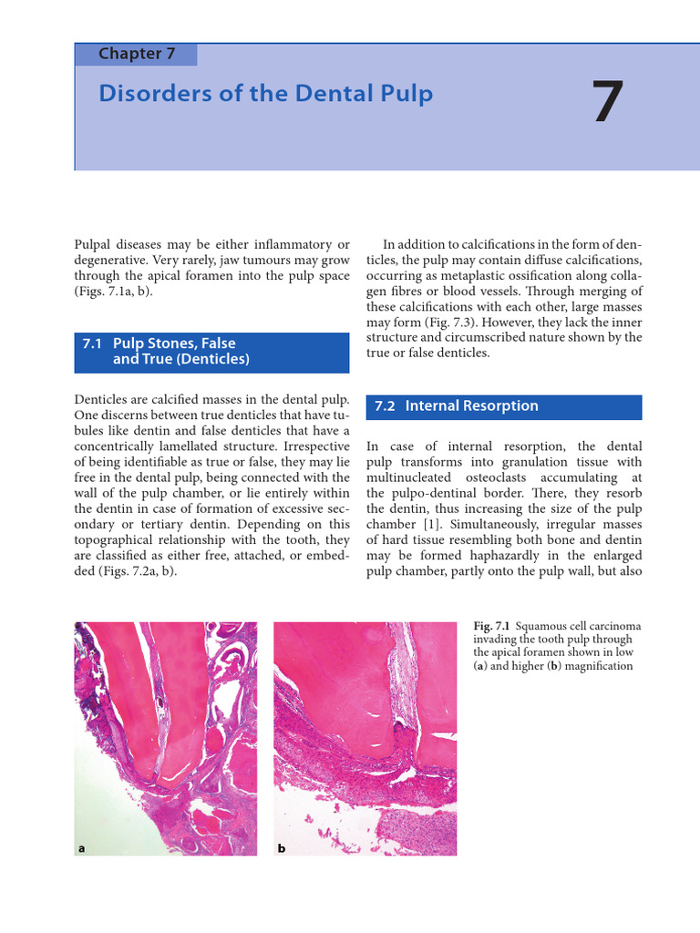 Disorders of The Dental Pulp | PDF | Medical Specialties | Tissue (Biology)