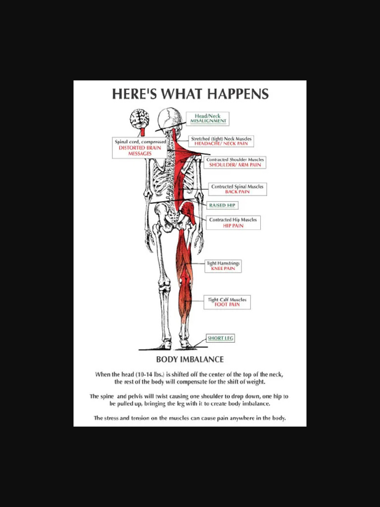 Body Imbalance 1 | PDF