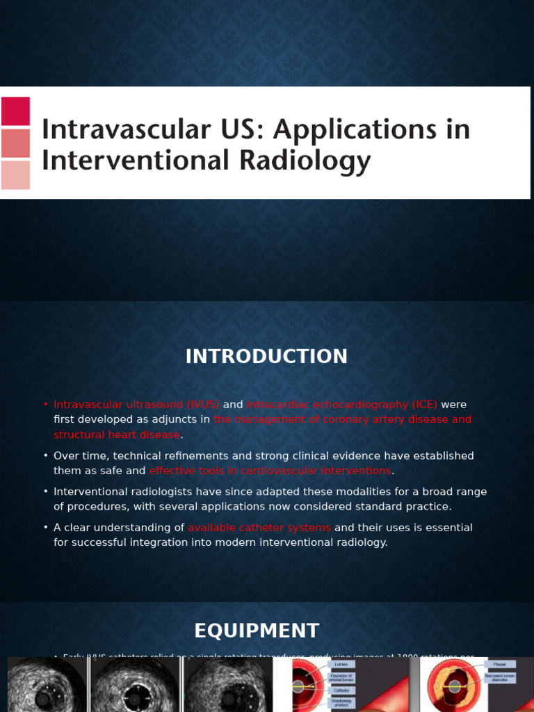 IVUS and ICE in Interventional Radiology | PDF | Vein | Angiography