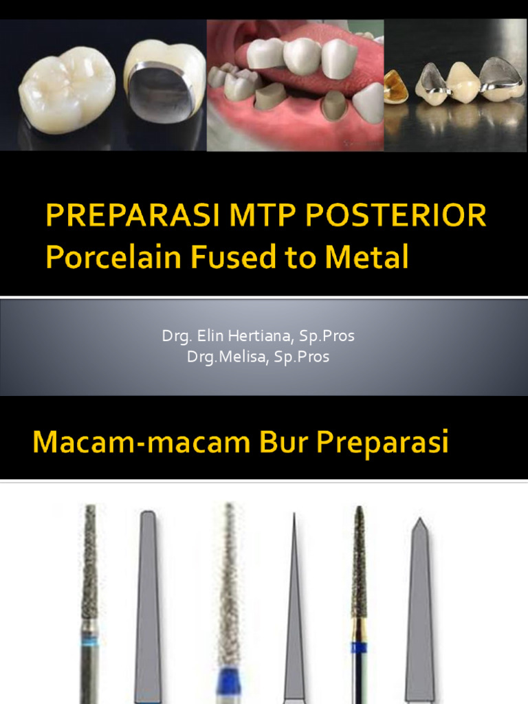 Tahapan Preparasi Gigi untuk Prostodonsia | PDF