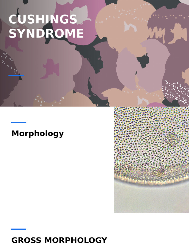 Cushings Syndrome | PDF