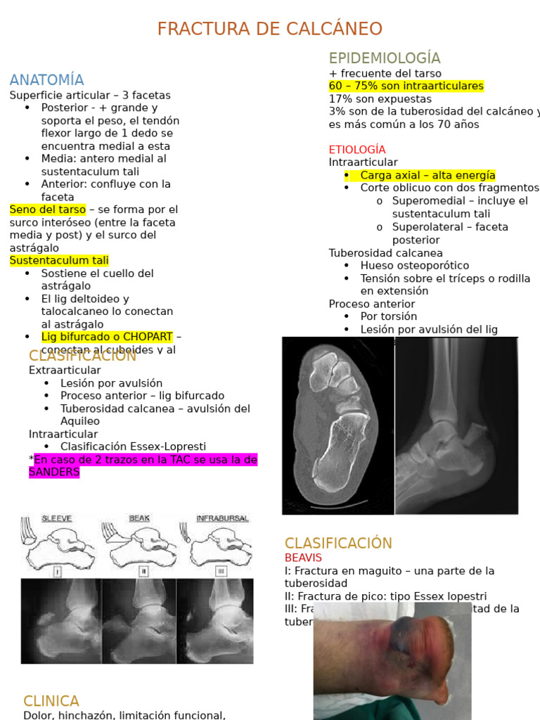 FX Calcaneo | PDF | Anatomía del miembro inferior | Extremidades (anatomía)