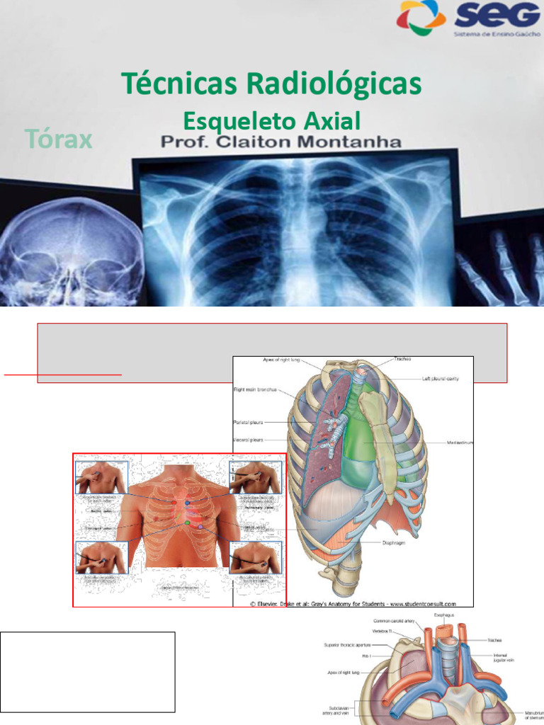 Anatomia e Funções do Tórax Esquelético | PDF | Anatomia humana | Anatomia