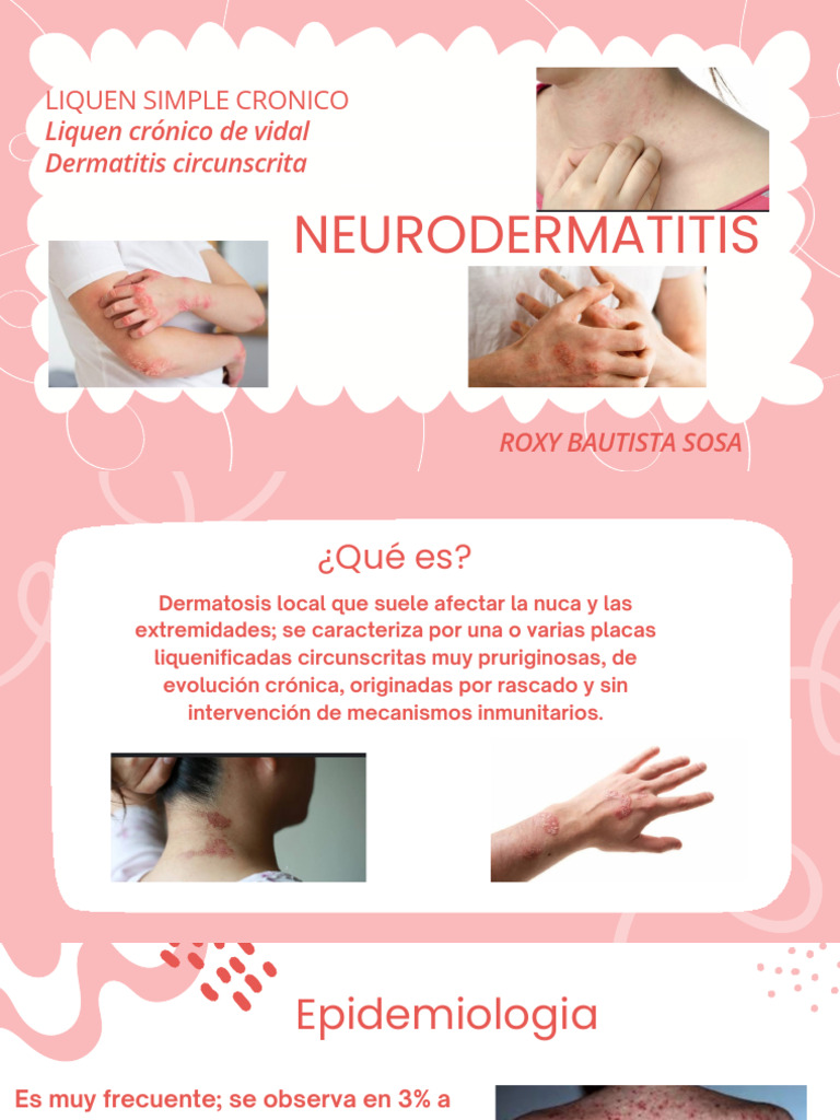 Neurodermatitis: Causas y Tratamiento | PDF | Enfermedades y trastornos ...