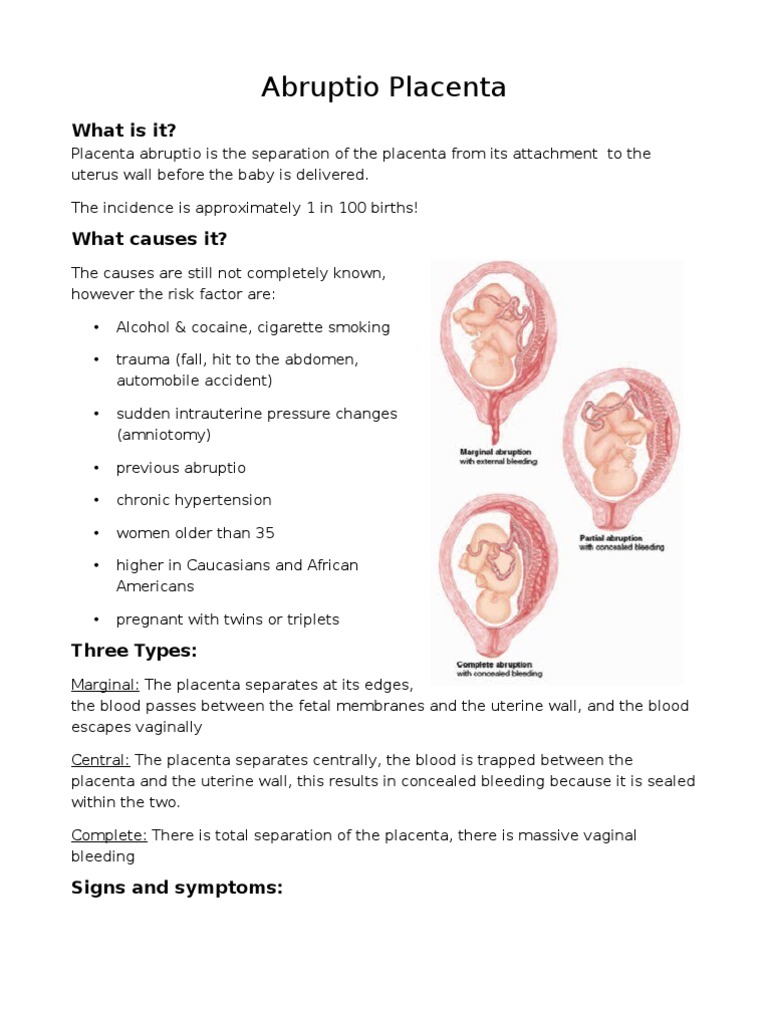 Abruptio Placenta | PDF | Self-Improvement | Science & Mathematics