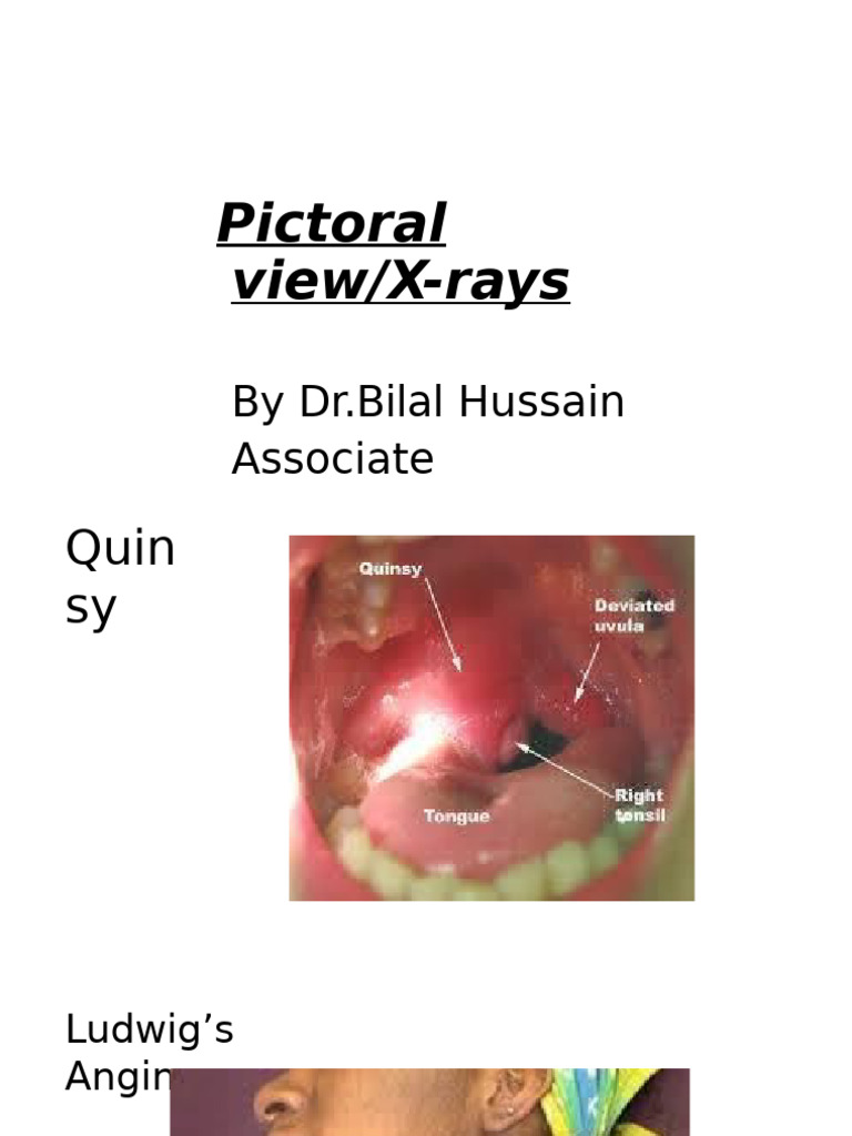 Pictoral Views X-Rays 2 | PDF