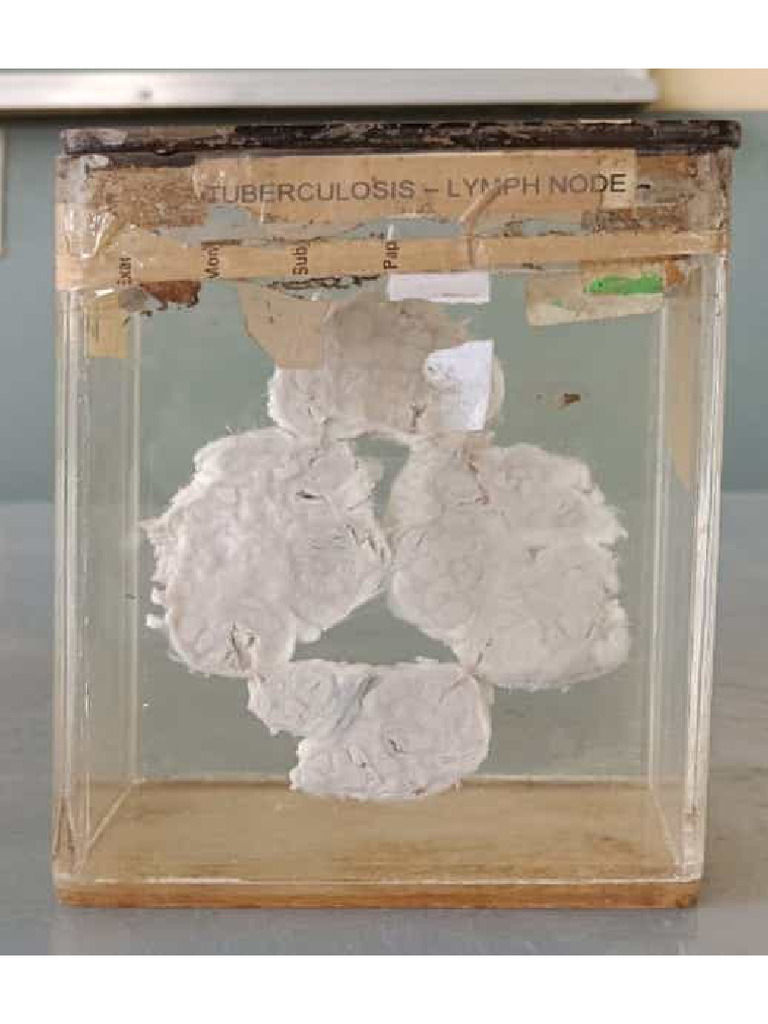 Patho Gross Specimens 1st Block | PDF