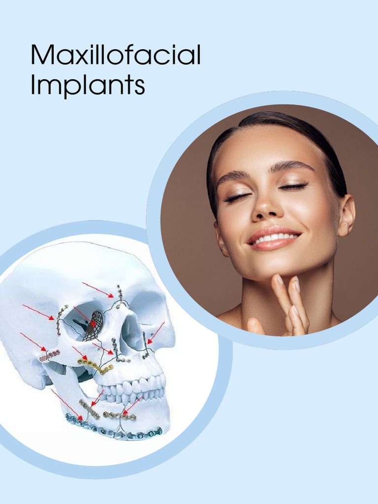 Maxillofacial Implant Catalog by GWS | PDF