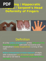 Understanding Clubbing and Its Grades | PDF