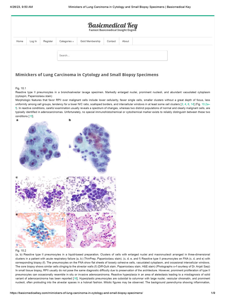 Mimickers of Lung Carcinoma in Cytology and Biopsy | PDF ...