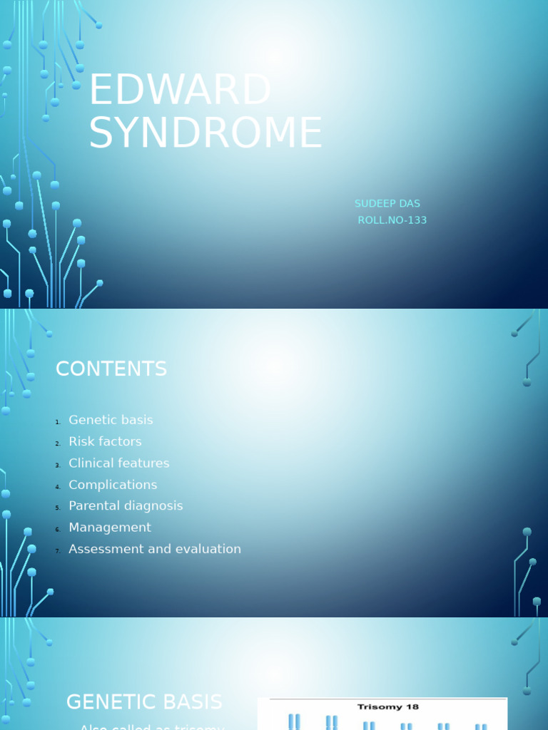 Edward Syndrome | PDF