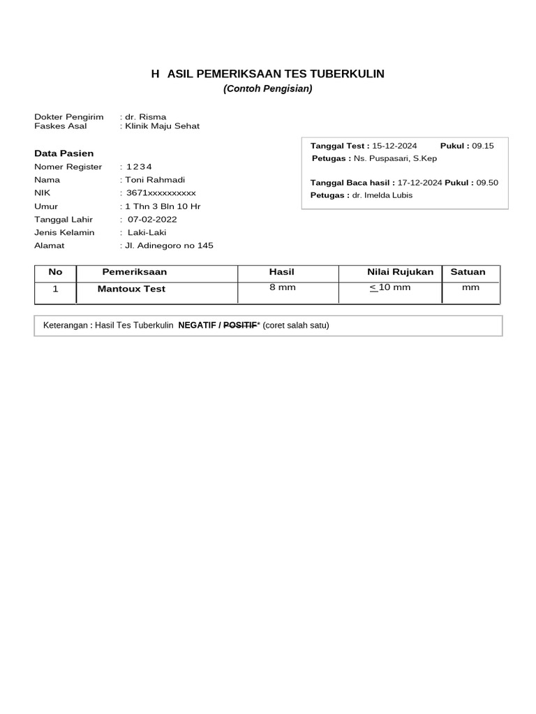 Hasil Tes Tuberkulin Pasien Anak | PDF