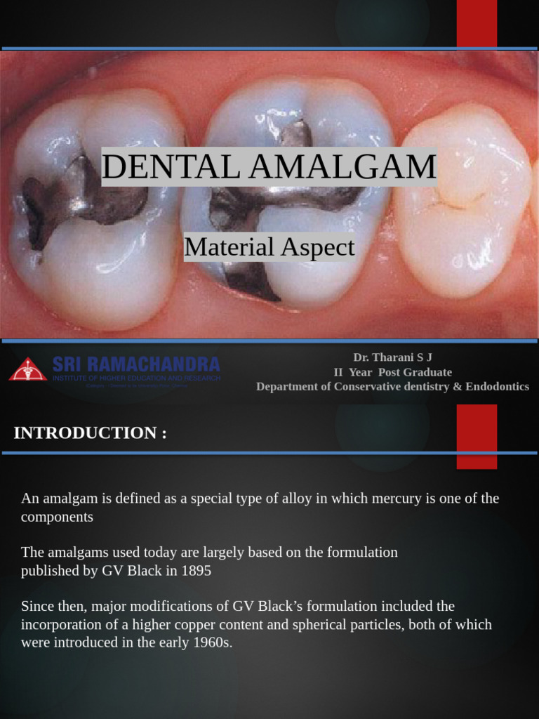 Amalgam - Material Aspect | PDF | Materials | Metals