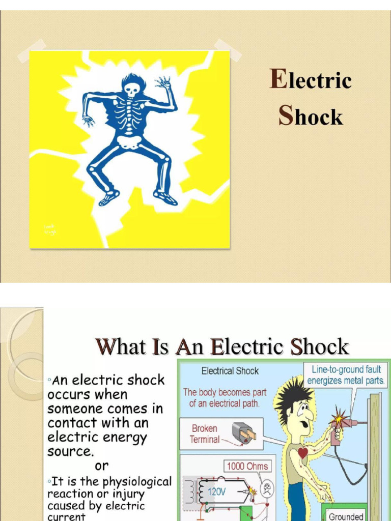 Electric Shock | PDF