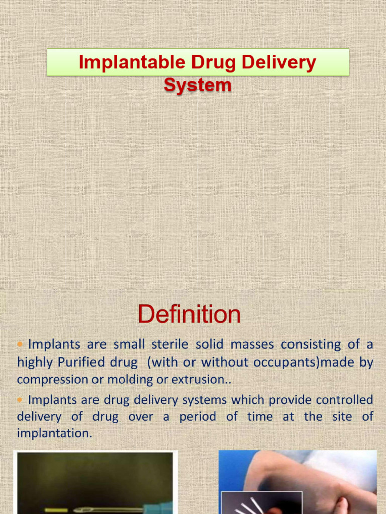 Implantable DDS1 | PDF