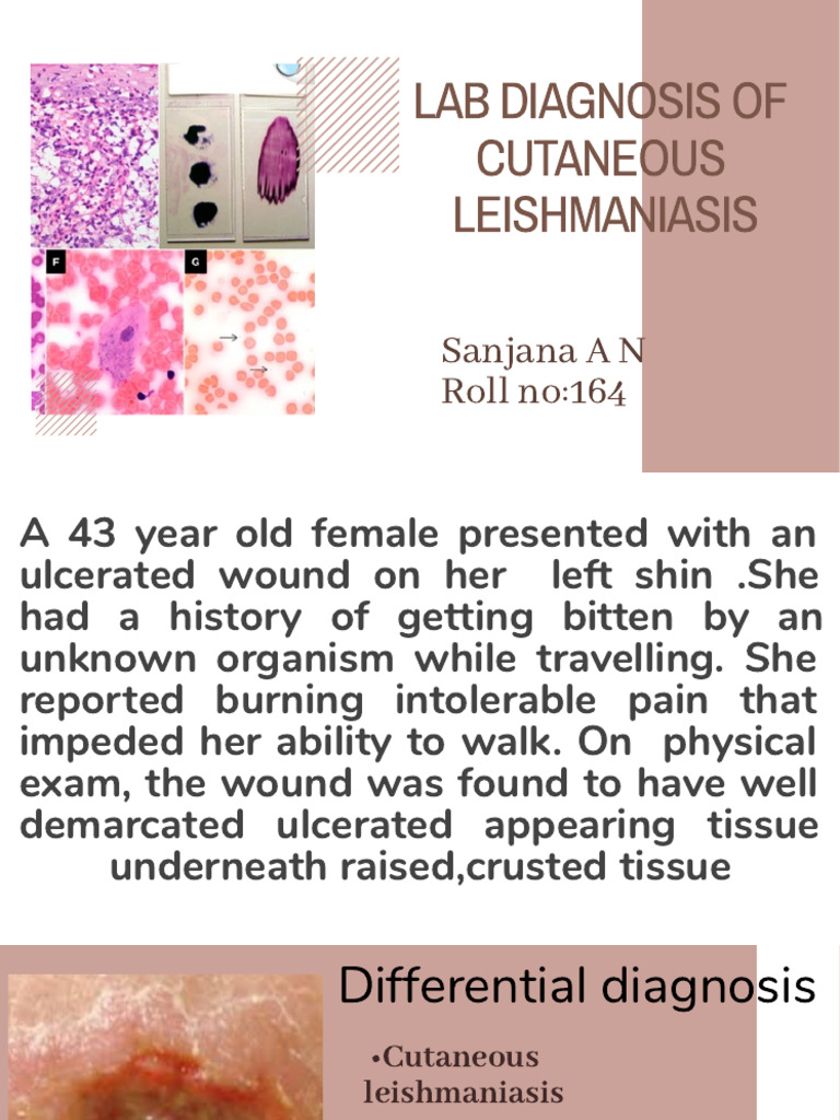Microbiology Cutaneous Leishmaniasis | PDF | Polymerase Chain Reaction ...
