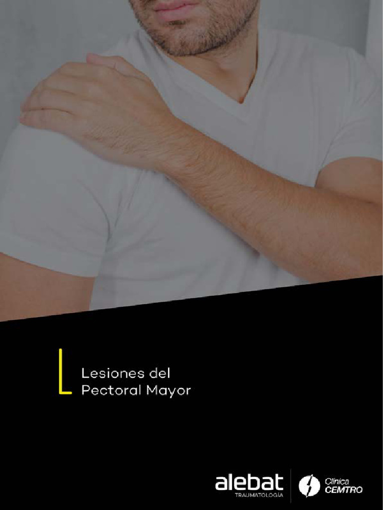 Rotura del Pectoral Mayor: Diagnóstico y Tratamiento | PDF | Hombro ...