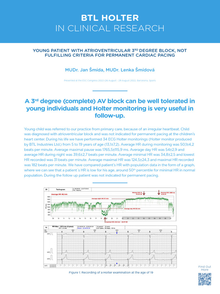 Young Patient with 3rd Degree AV Block | PDF