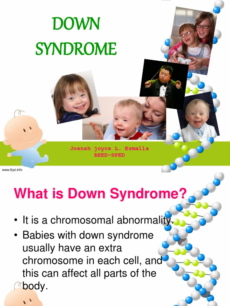 Down Syndrome | Down Syndrome | Chromosome