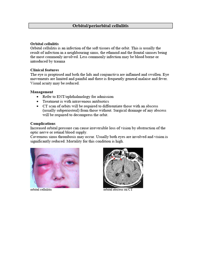 Orbital Cellulitis: Diagnosis and Management | PDF