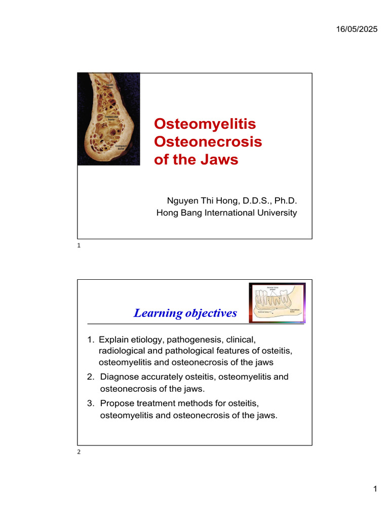 4 Osteomyelitis Osteonecrosis | PDF | Medical Specialties | Diseases ...
