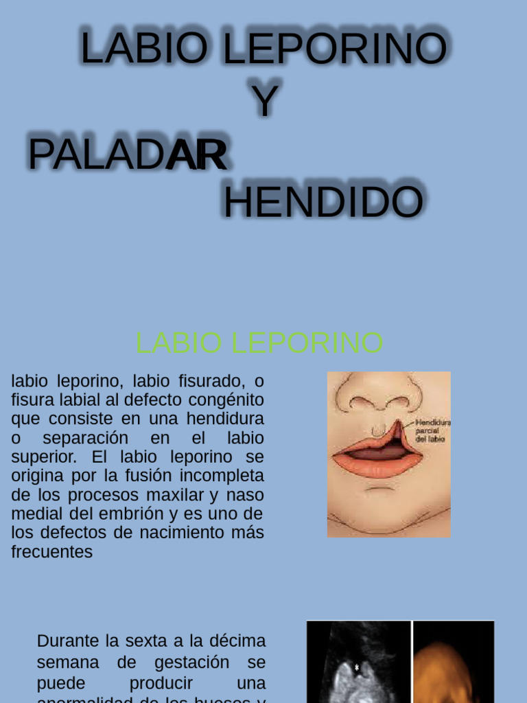 Labio Leporino y Paladar Hendido | PDF | Enfermedades y trastornos ...
