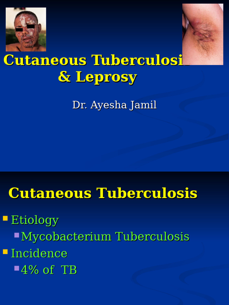 Cutaneous Tuberculosis Overview | PDF | Leprosy | Tuberculosis