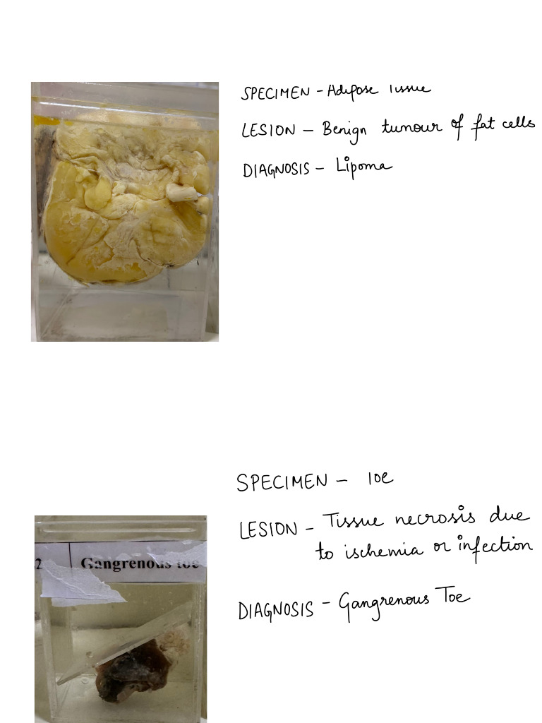 Pathology Specimens 2 | PDF