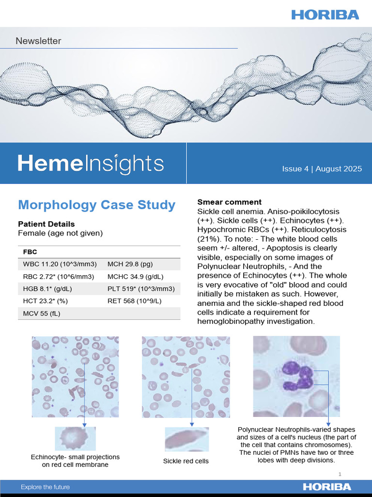 Heme Insights 4 August 2025 HORIBA | PDF | Platelet | White Blood Cell