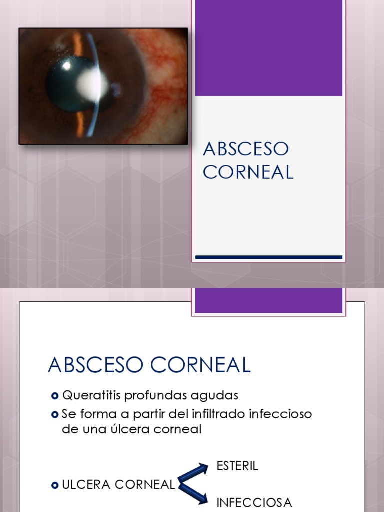 Diagnóstico y Tratamiento de Absceso Corneal | PDF | Córnea | Inflamación