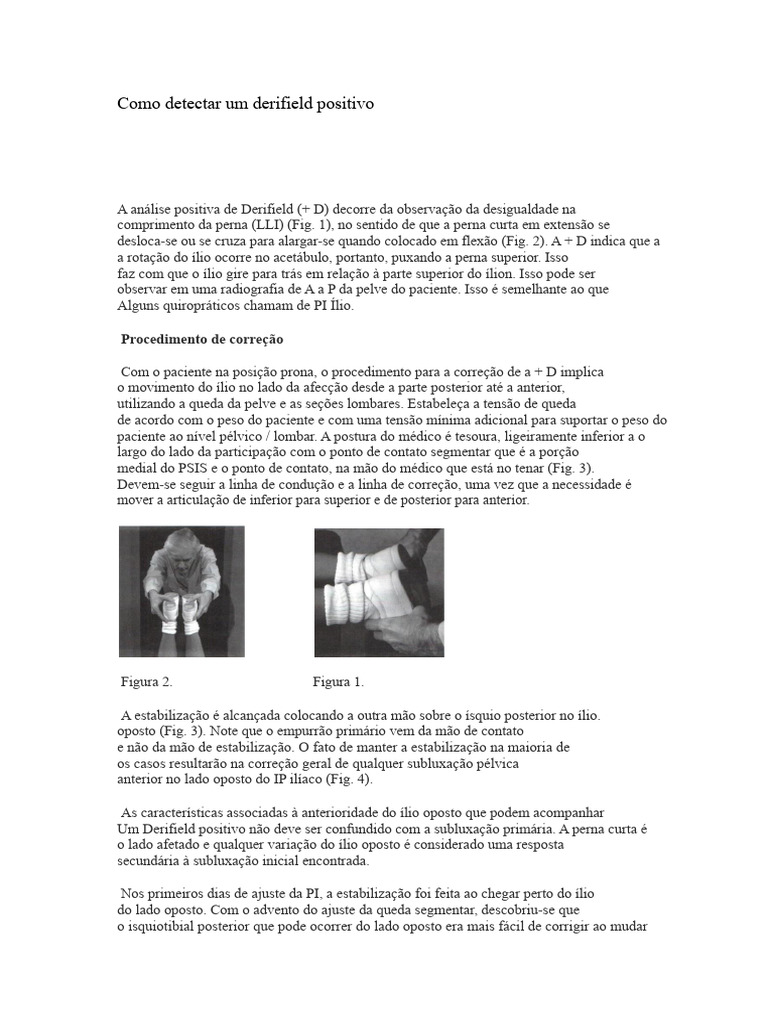 Detecção de Derifield Positivo | PDF | Pélvis