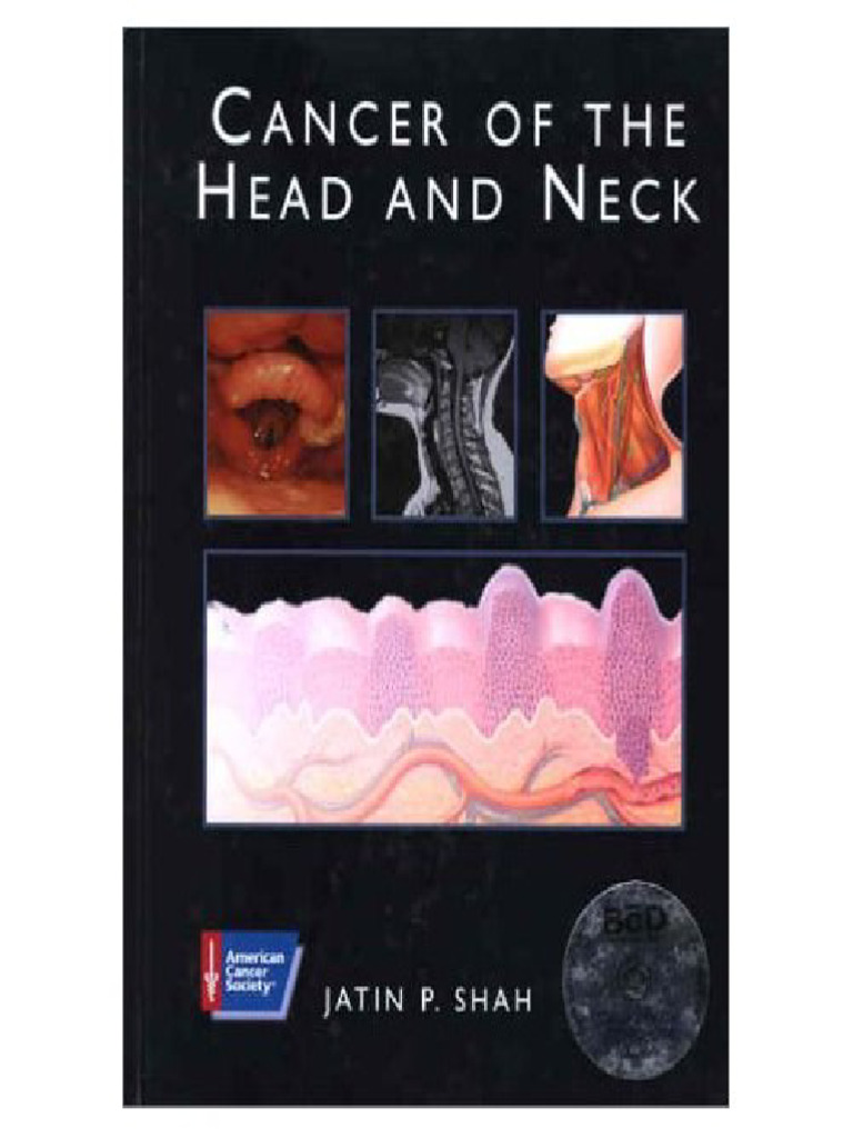 Head and Neck Cancer Overview | PDF | Head And Neck Cancer ...