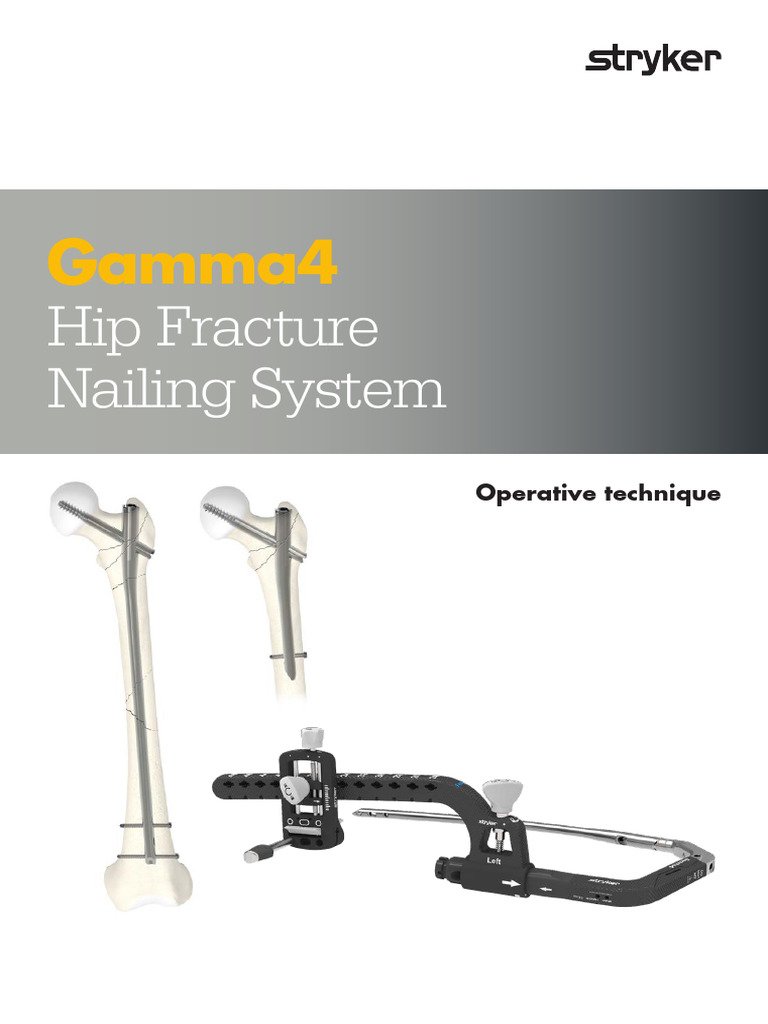 Gamma4 Hip Fracture Nailing Guide | PDF | Magnetic Resonance Imaging | Hip