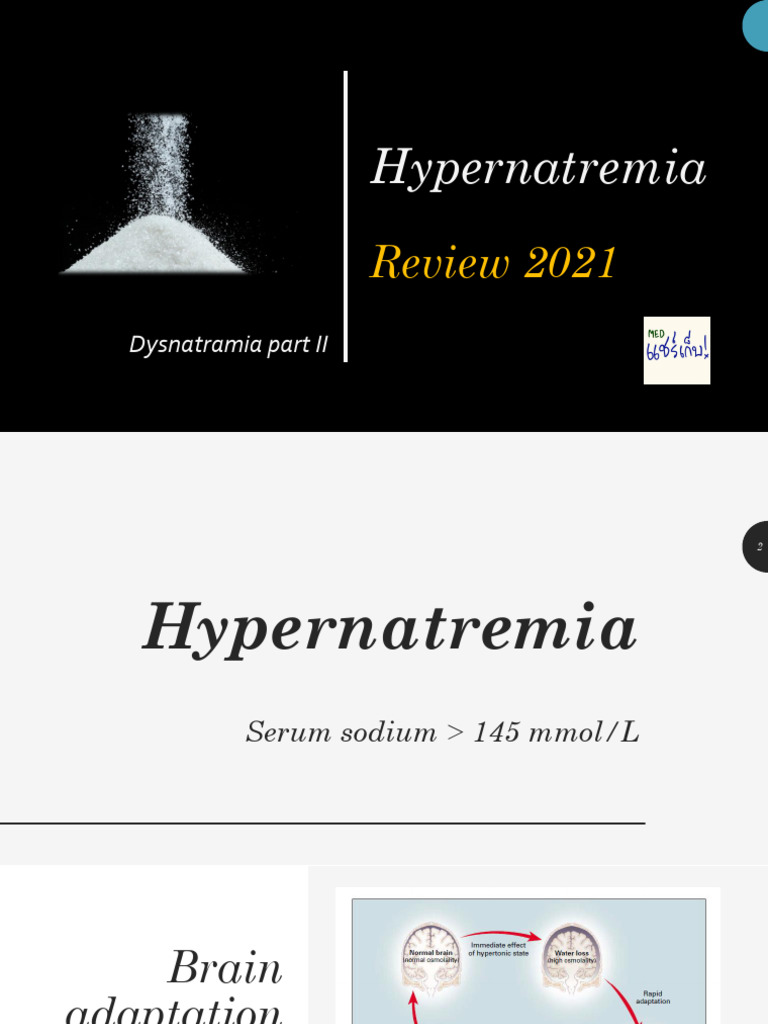Understanding Hypernatremia: Diagnosis & Treatment | PDF | Kidney ...