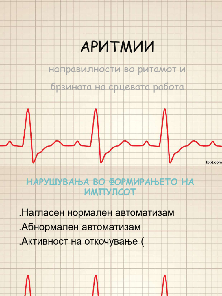 Aritmii, 6 | PDF