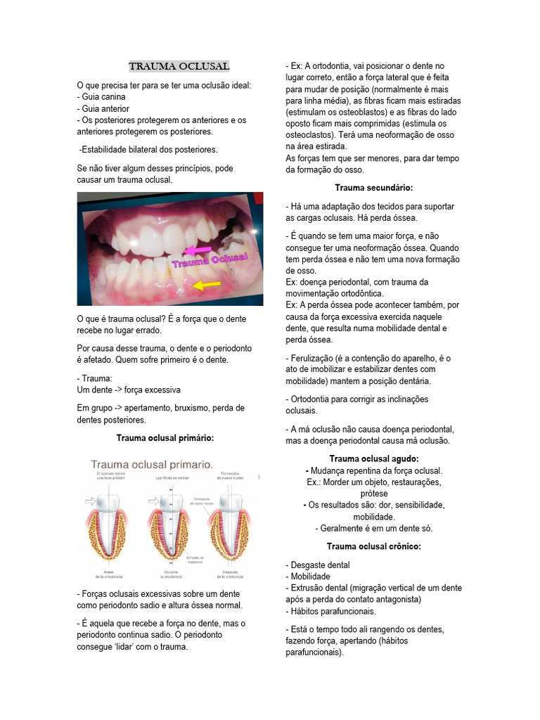 Oclusão Trauma Oclusal | PDF | Dente humano | Especialidades médicas