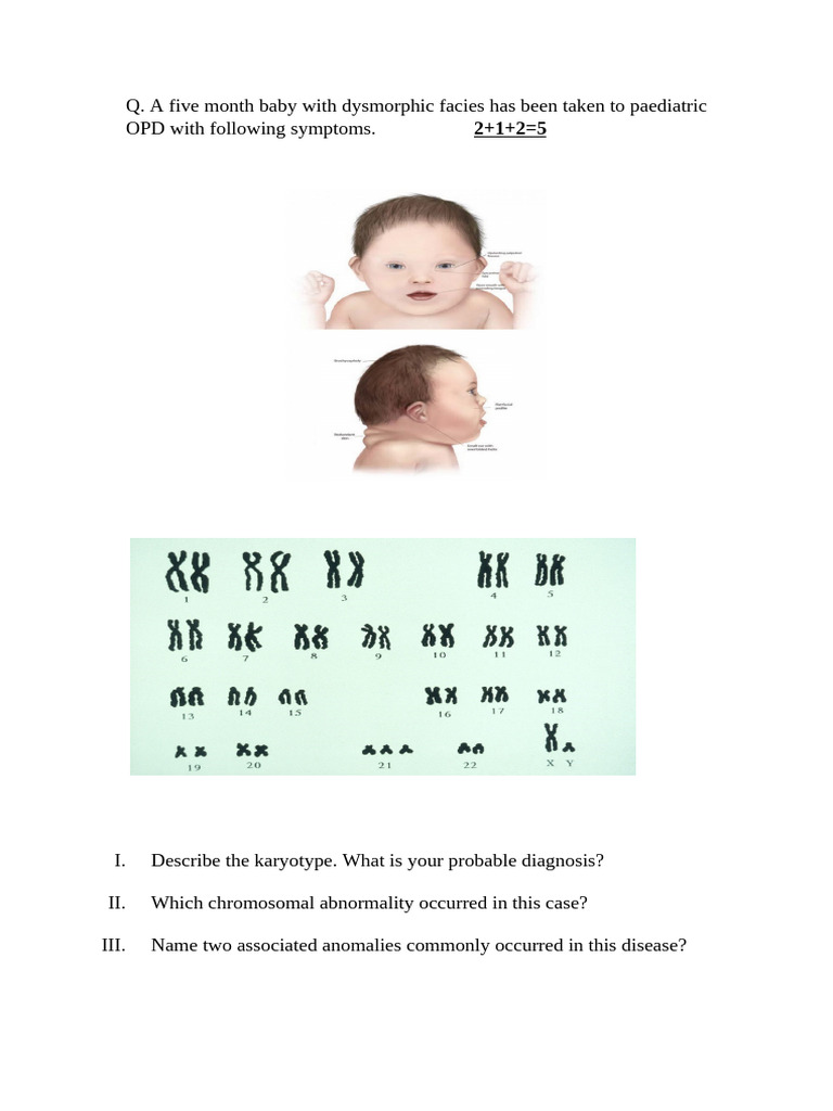 Ospe - Down Syndrome | PDF