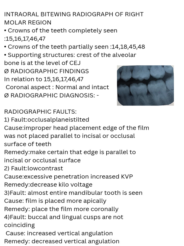 Bitewing Radiograph 2 | PDF