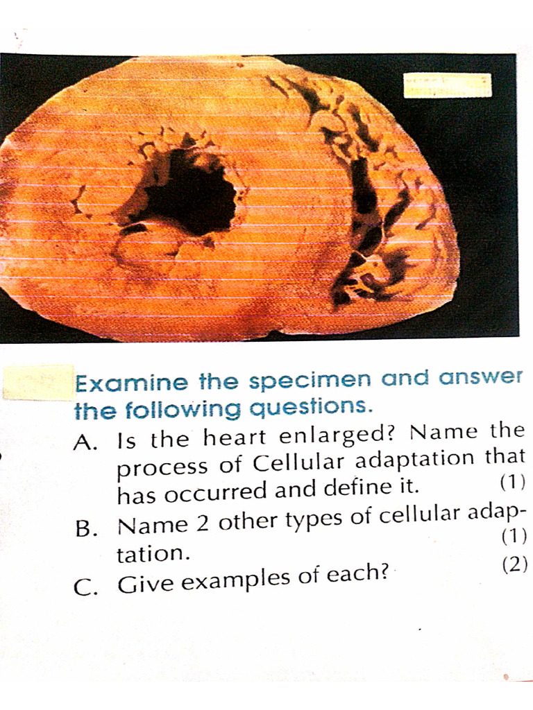 Histo Pathology Specimens | PDF