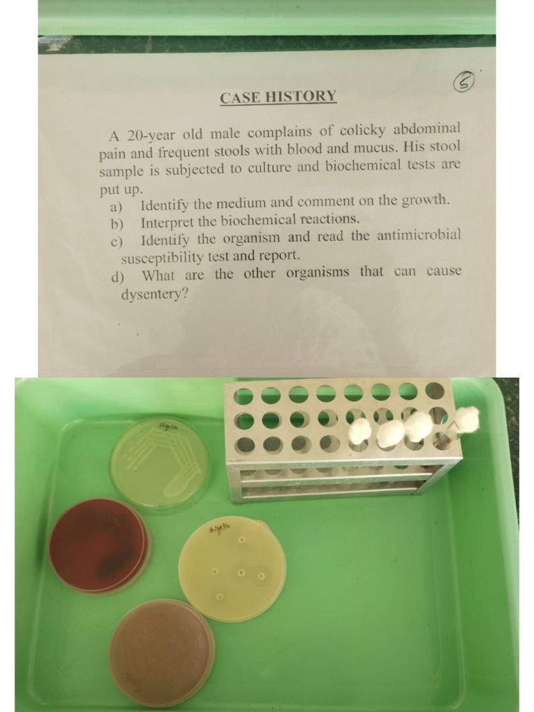 Shigella Case | PDF