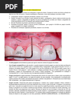 Anatomia e Funções da Gengiva | PDF | Boca | Anatomia