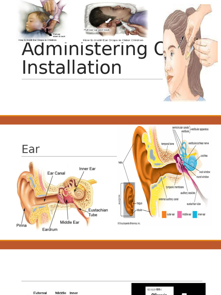 Administering Otic Installation | PDF