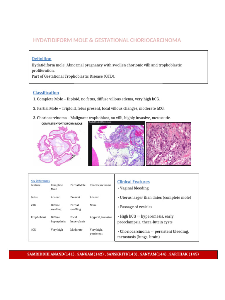 Hydatidiform Mole Poster (OG by Sanyam) | PDF