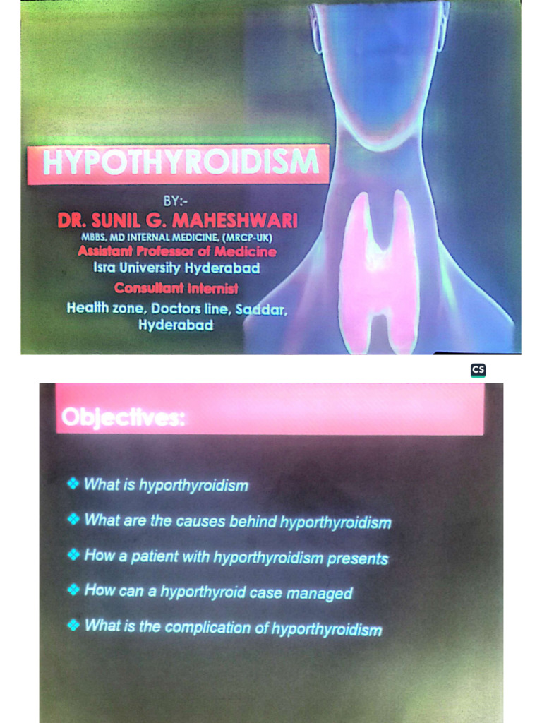 Hypo Thyroid Is M | PDF