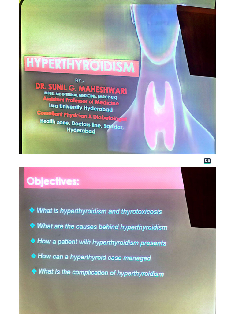 Hyperthyroid Is M | PDF