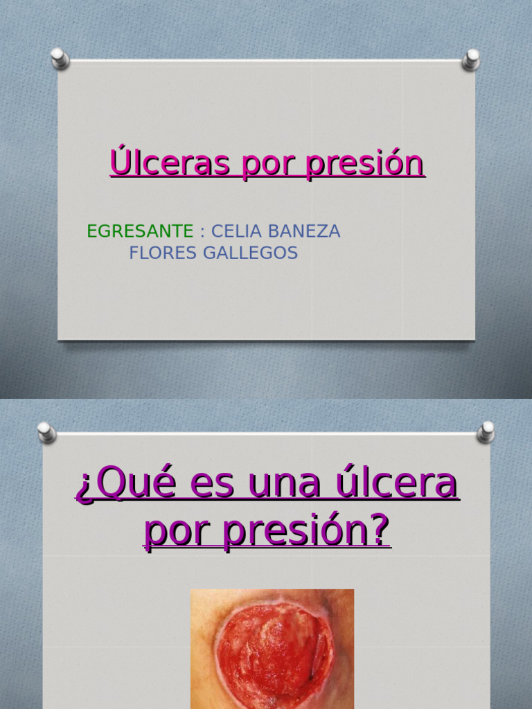 Guía sobre Úlceras por Presión: Causas y Cuidados | PDF | Colchón ...